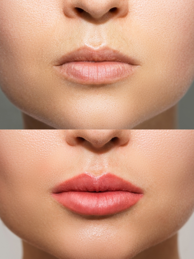 Lip Blush: What Is It and How Does It Work? - Minou Nails